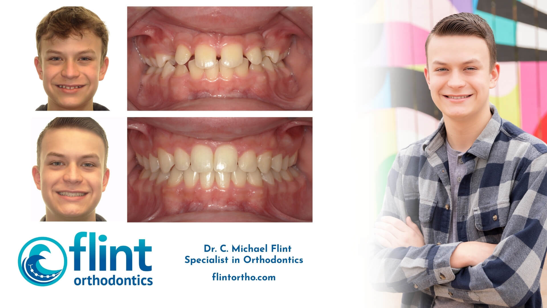 Kilgore Orthodontist | Henderson Orthodontist | Longview | Tyler ...