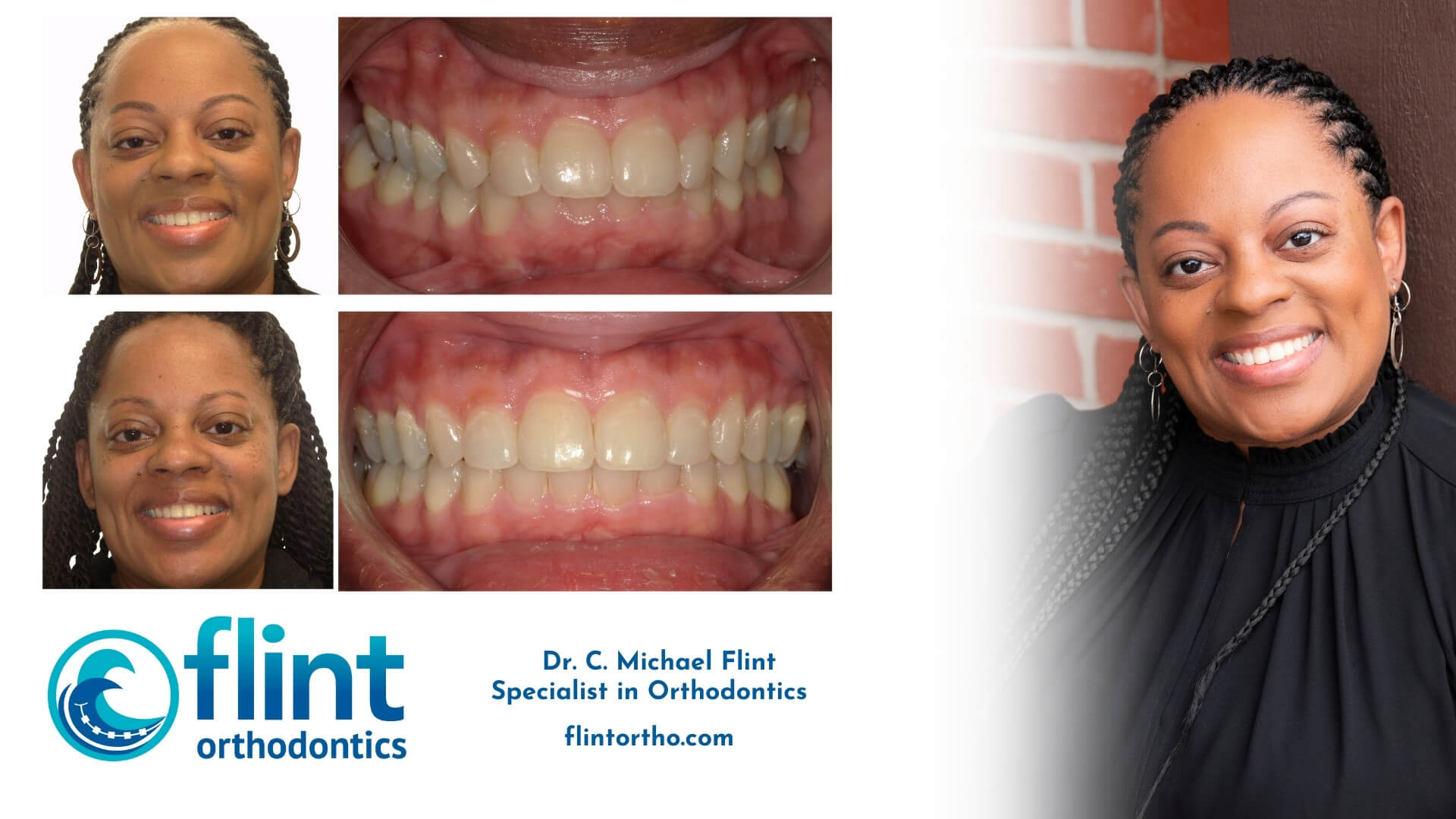 Kilgore Orthodontist | Henderson Orthodontist | Longview | Tyler ...