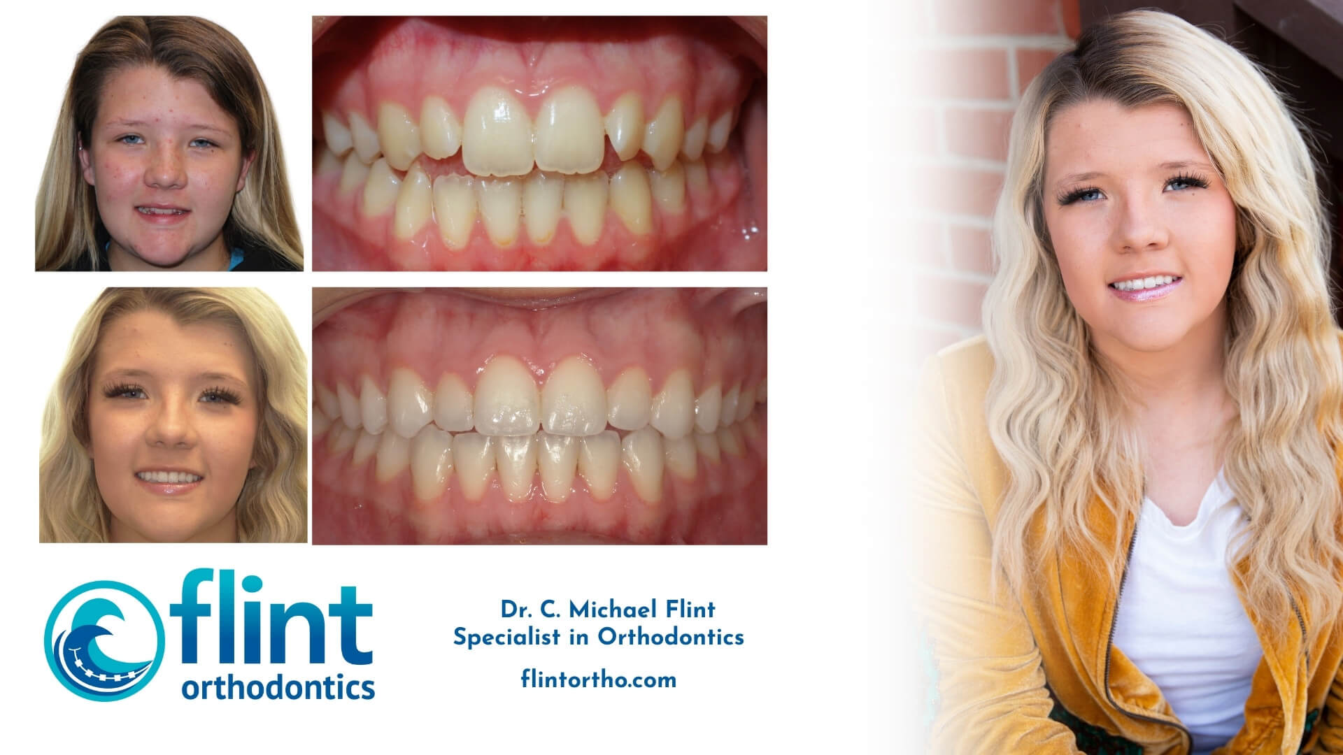 Kilgore Orthodontist | Henderson Orthodontist | Longview | Tyler ...