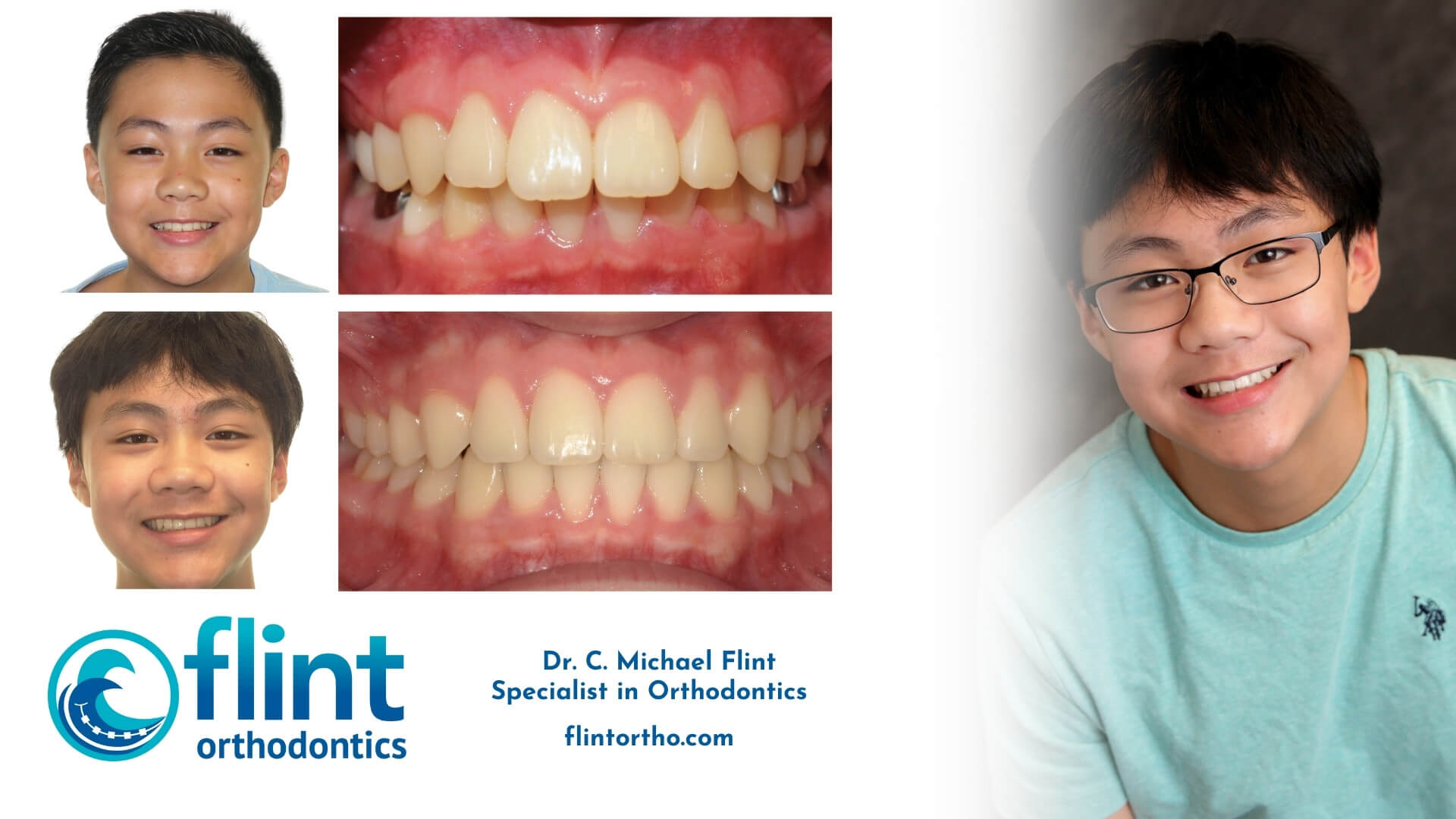 Kilgore Orthodontist | Henderson Orthodontist | Longview | Tyler ...