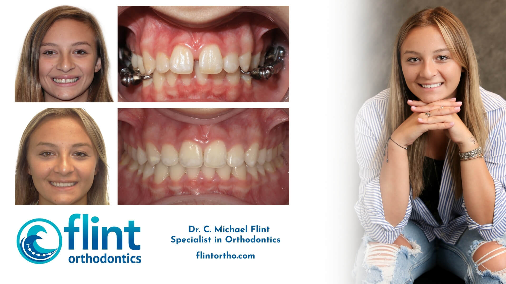 Kilgore Orthodontist | Henderson Orthodontist | Longview | Tyler ...