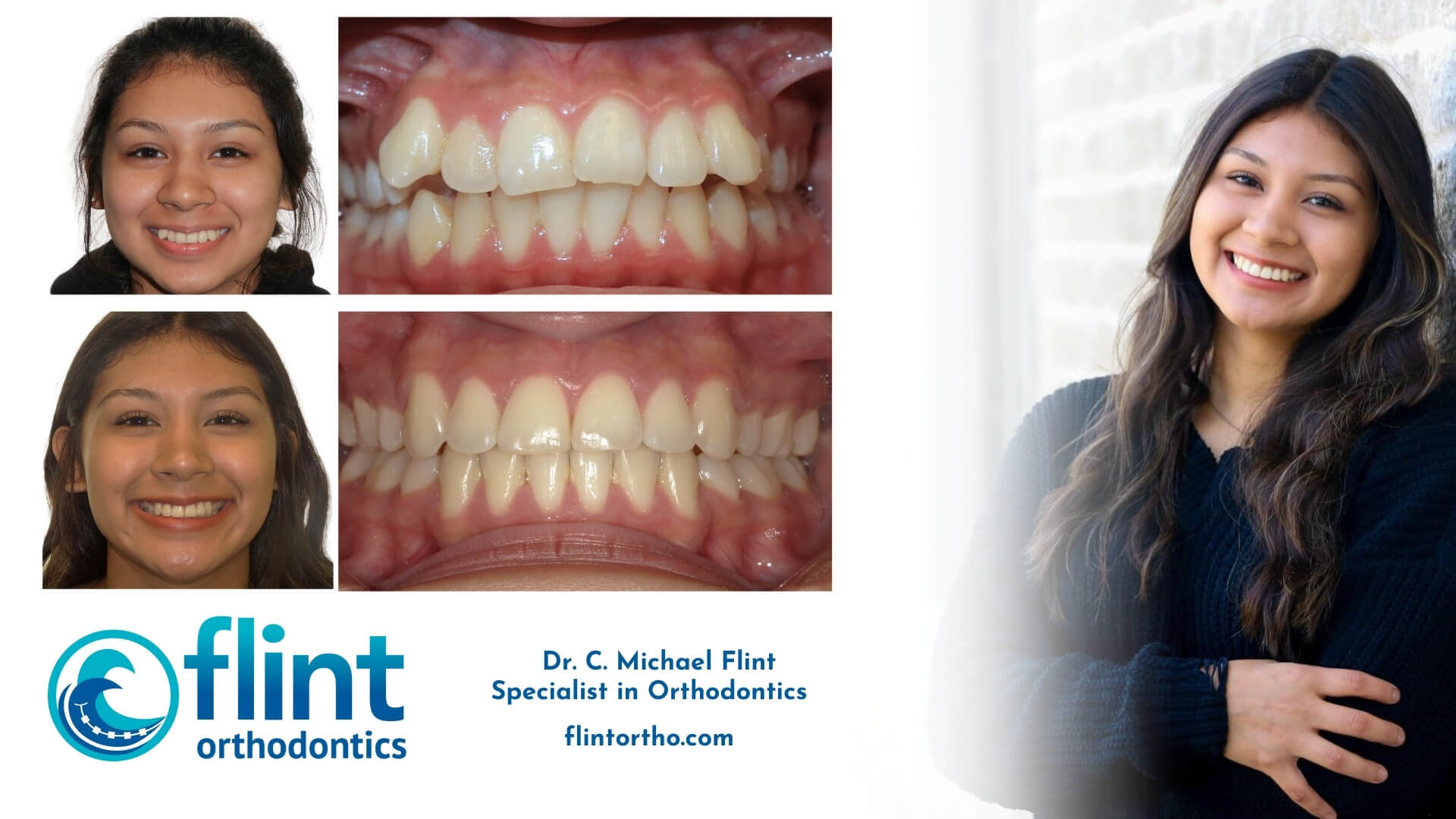 Kilgore Orthodontist | Henderson Orthodontist | Longview | Tyler ...