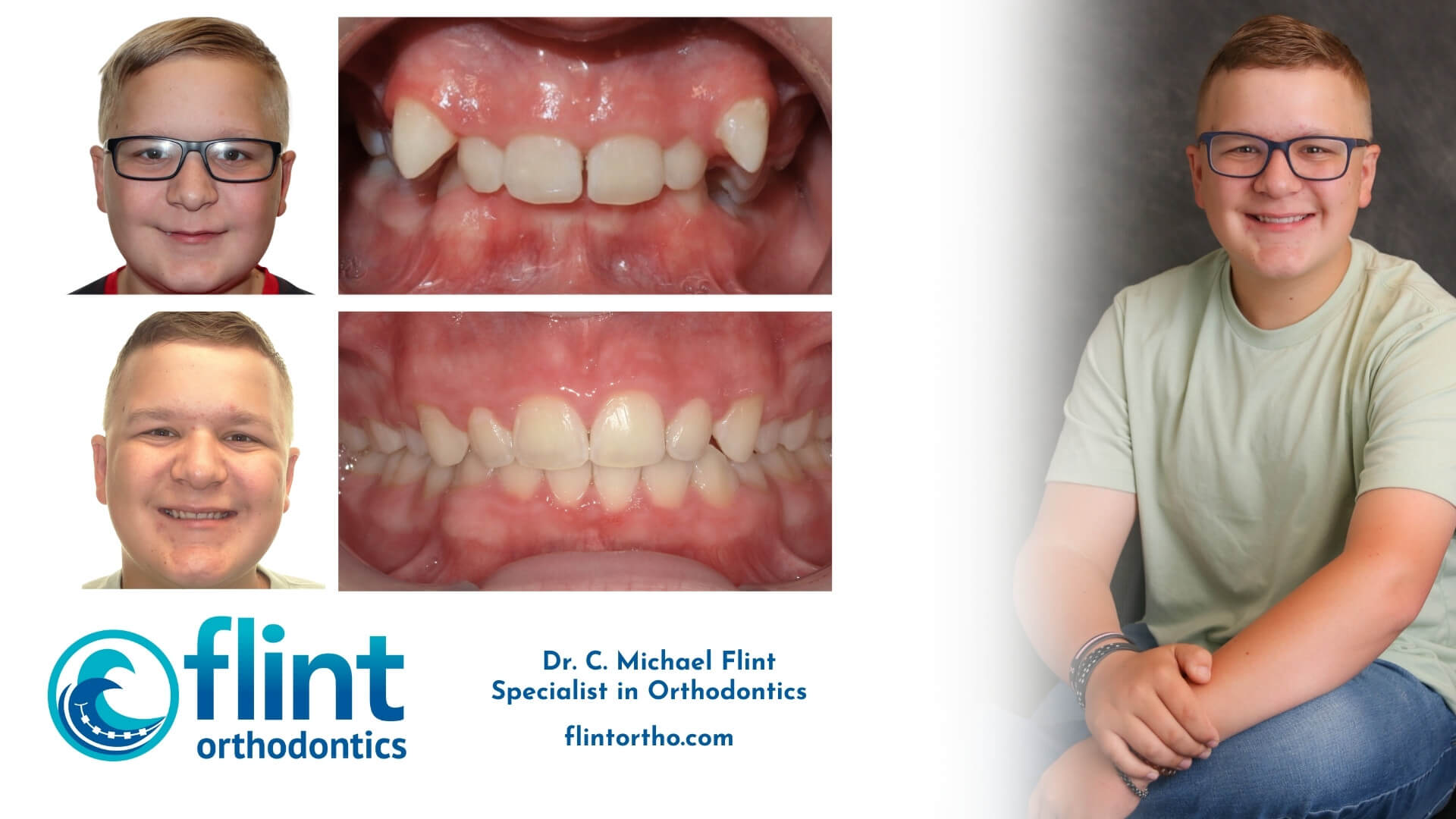 Kilgore Orthodontist | Henderson Orthodontist | Longview | Tyler ...