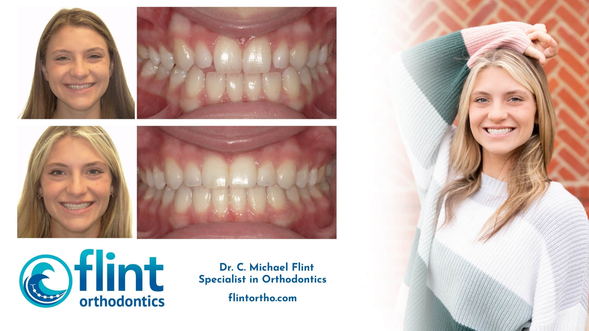 Kilgore Orthodontist | Henderson Orthodontist | Longview | Tyler ...